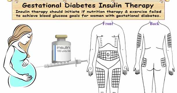 Gestational Diabetes Insulin Therapy Gestational Diabetes Medicine